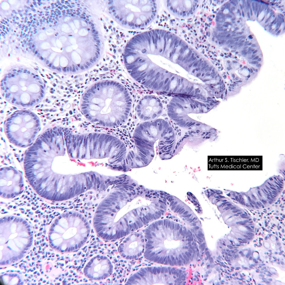 LabCam® and LabCam Ultra® iPhone Microscope Adapter | iDu Optics
