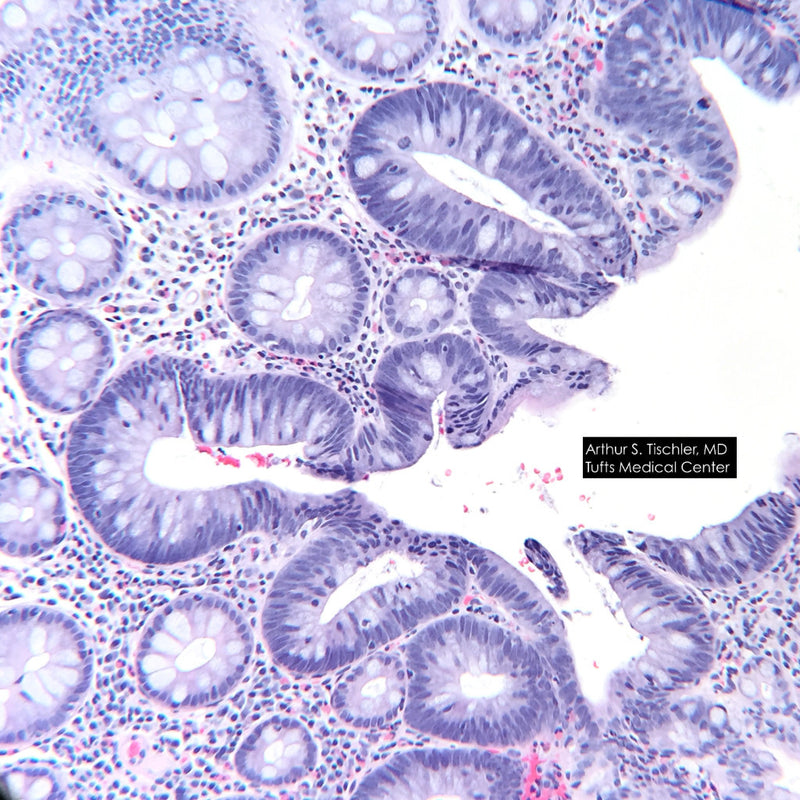 LabCam® and LabCam Ultra® iPhone Microscope Adapter | iDu Optics