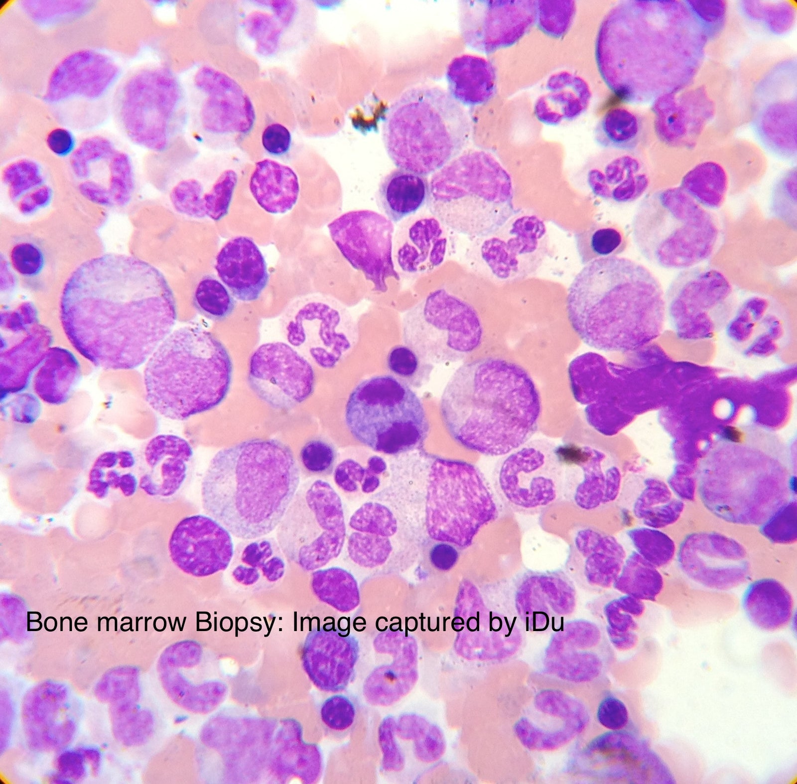 LabCam® and LabCam Ultra® iPhone Microscope Adapter | iDu Optics